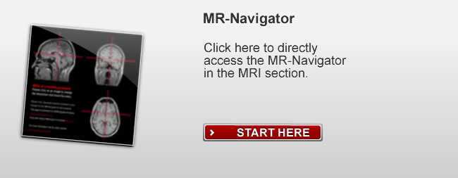 The Human Brain · Atlas of the Human Brain · www.thehumanbrain.info ...